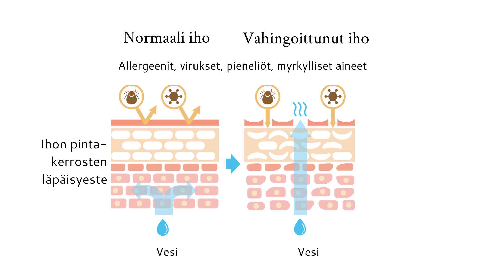 Ihon kerroksellisuus | Vihreä Ilo